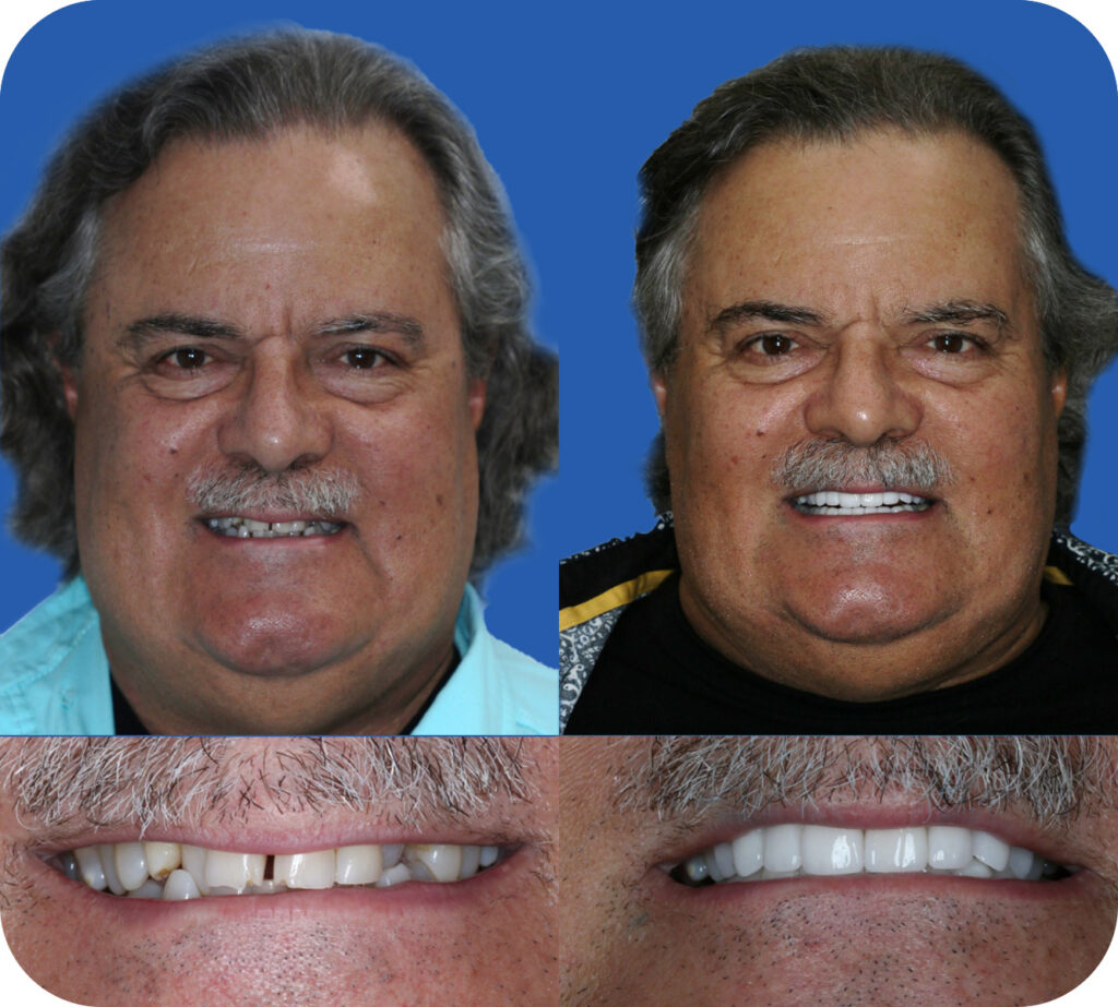 Dentist Corpus Christi | Implants & Family Care | Vela Dental